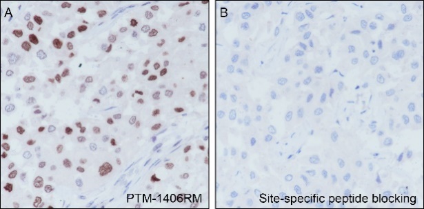 PTM BIO