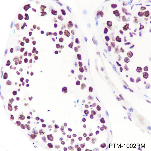 PTM BIO
