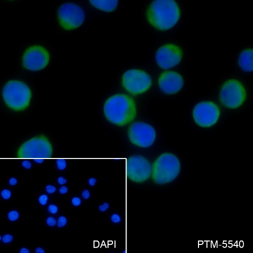 PTM BIO
