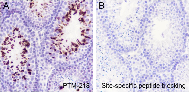 PTM BIO
