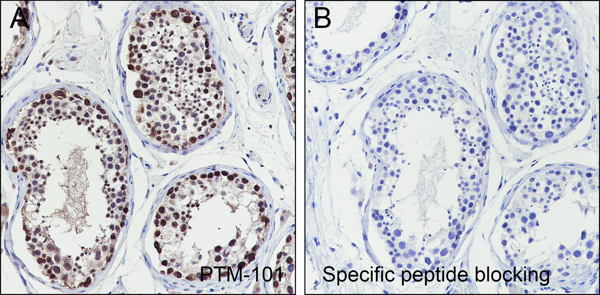 PTM BIO