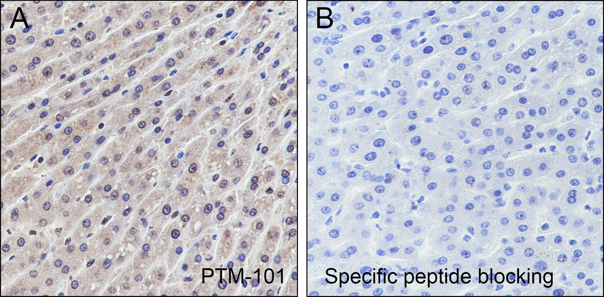 PTM BIO